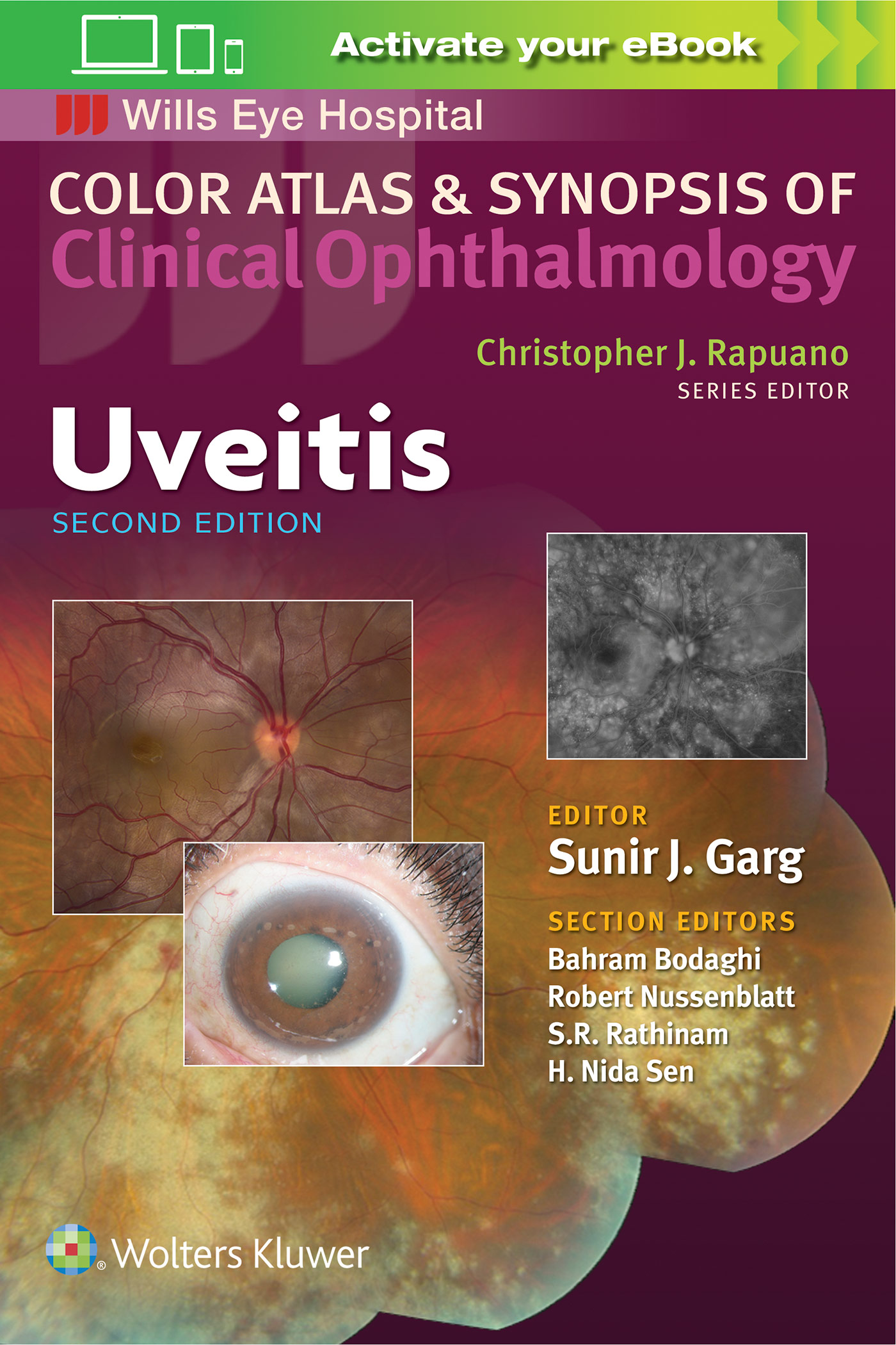 Wills Eye Hospital: Uveitis Third edition | Εκδόσεις Κωνσταντάρας