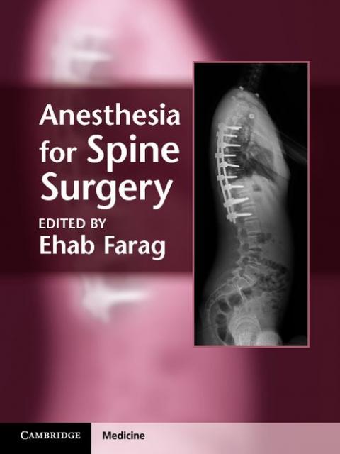 Anesthesia for Spine Surgery | Εκδόσεις Κωνσταντάρας