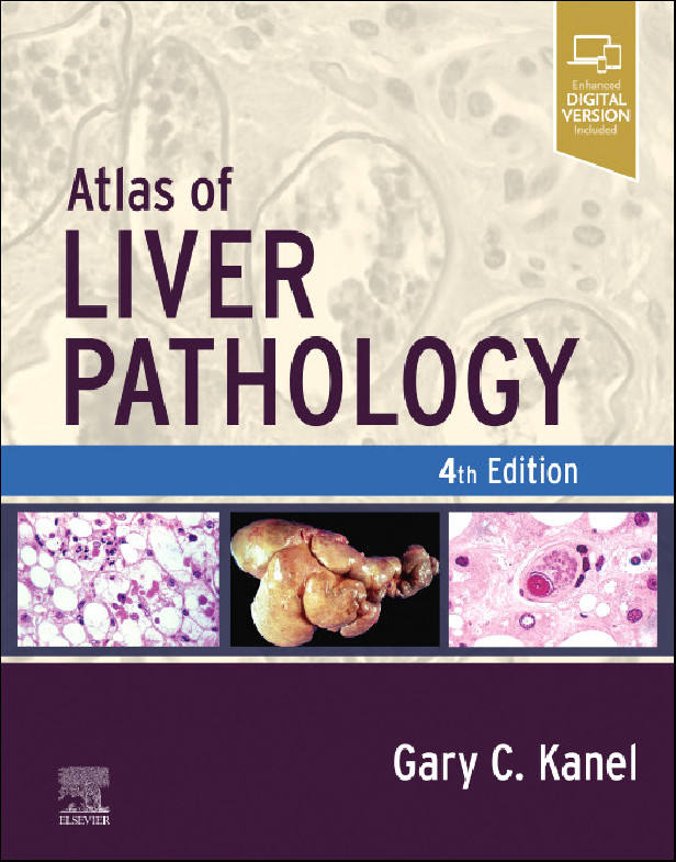 Atlas of Liver Pathology, 4th Edition | Εκδόσεις Κωνσταντάρας
