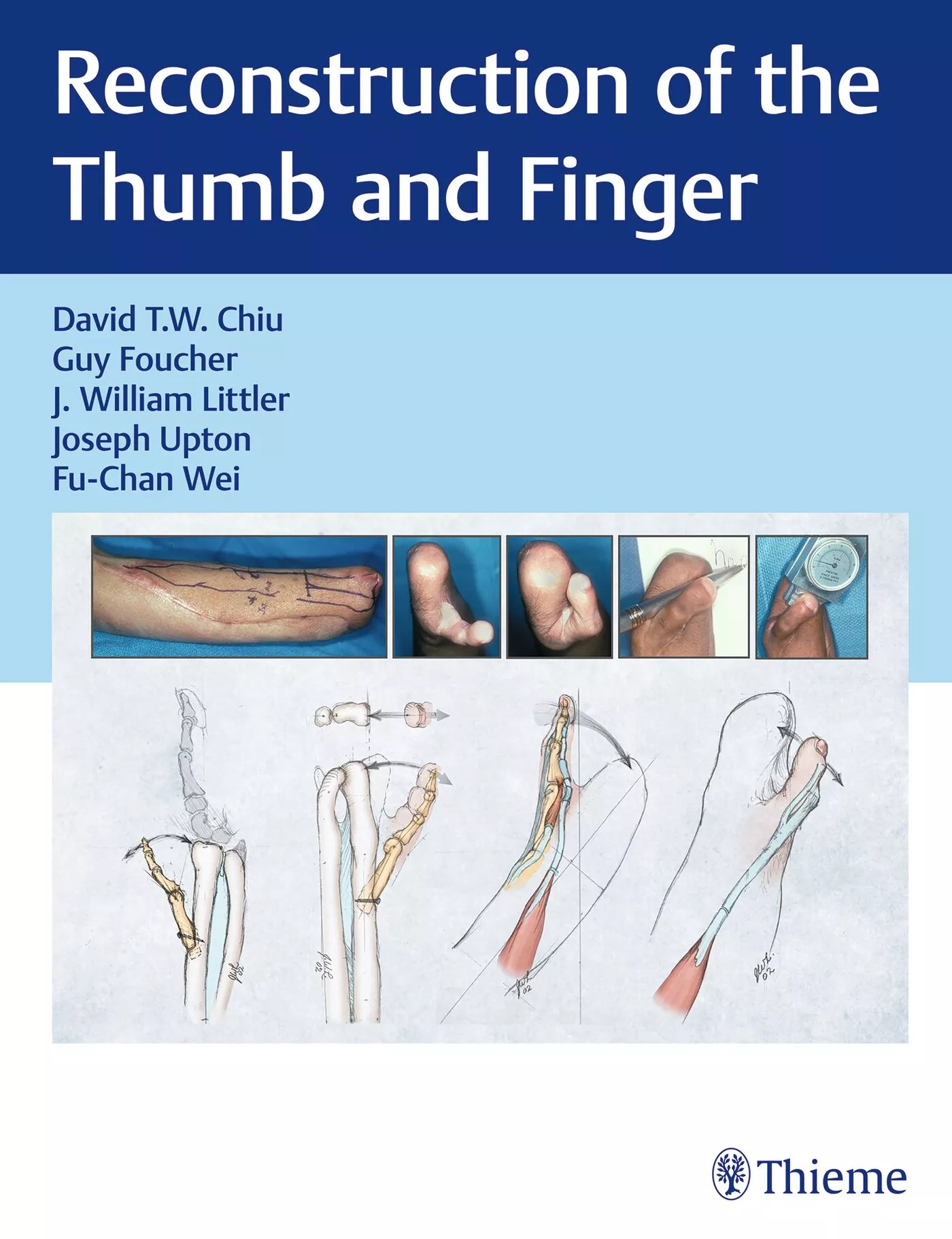 Reconstruction of the Thumb and Finger | Εκδόσεις Κωνσταντάρας
