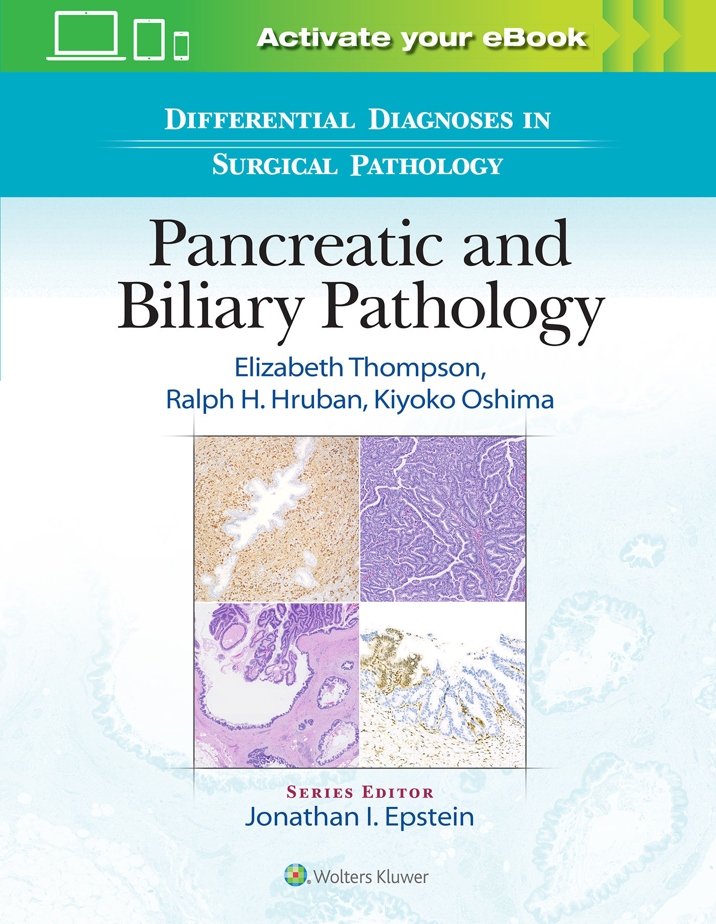 Differential Diagnoses in Surgical Pathology: Pancreatic and Biliary ...