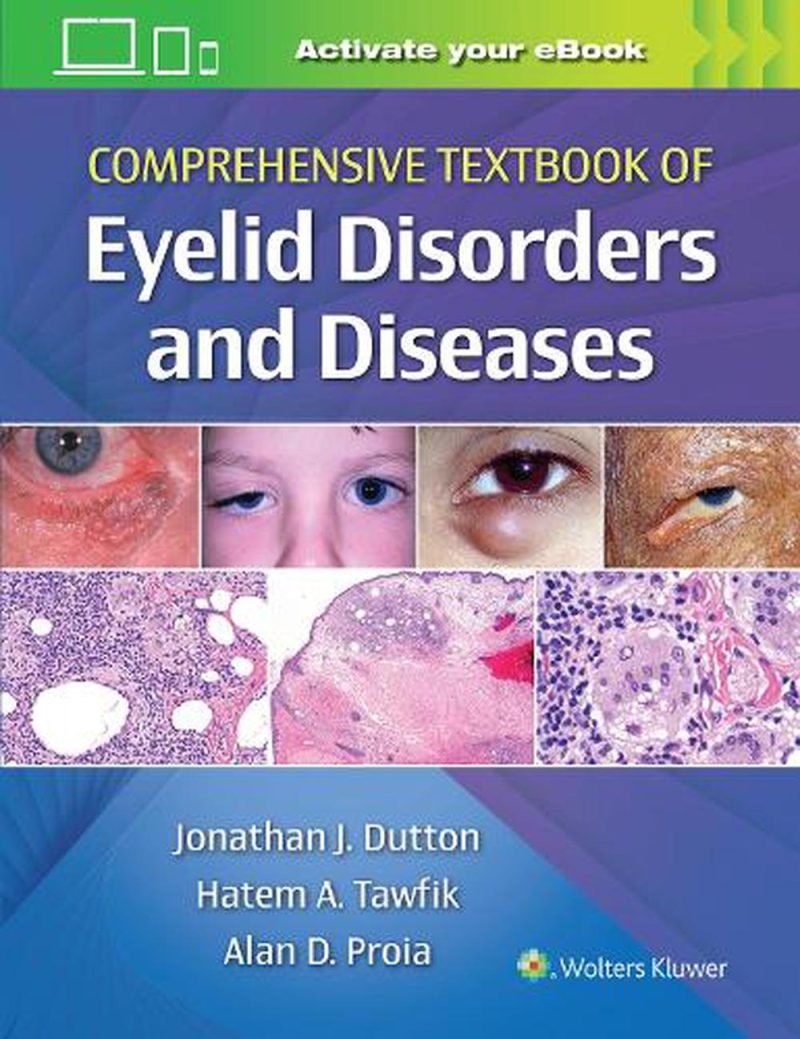 Comprehensive Textbook of Eyelid Disorders and Diseases First edition ...