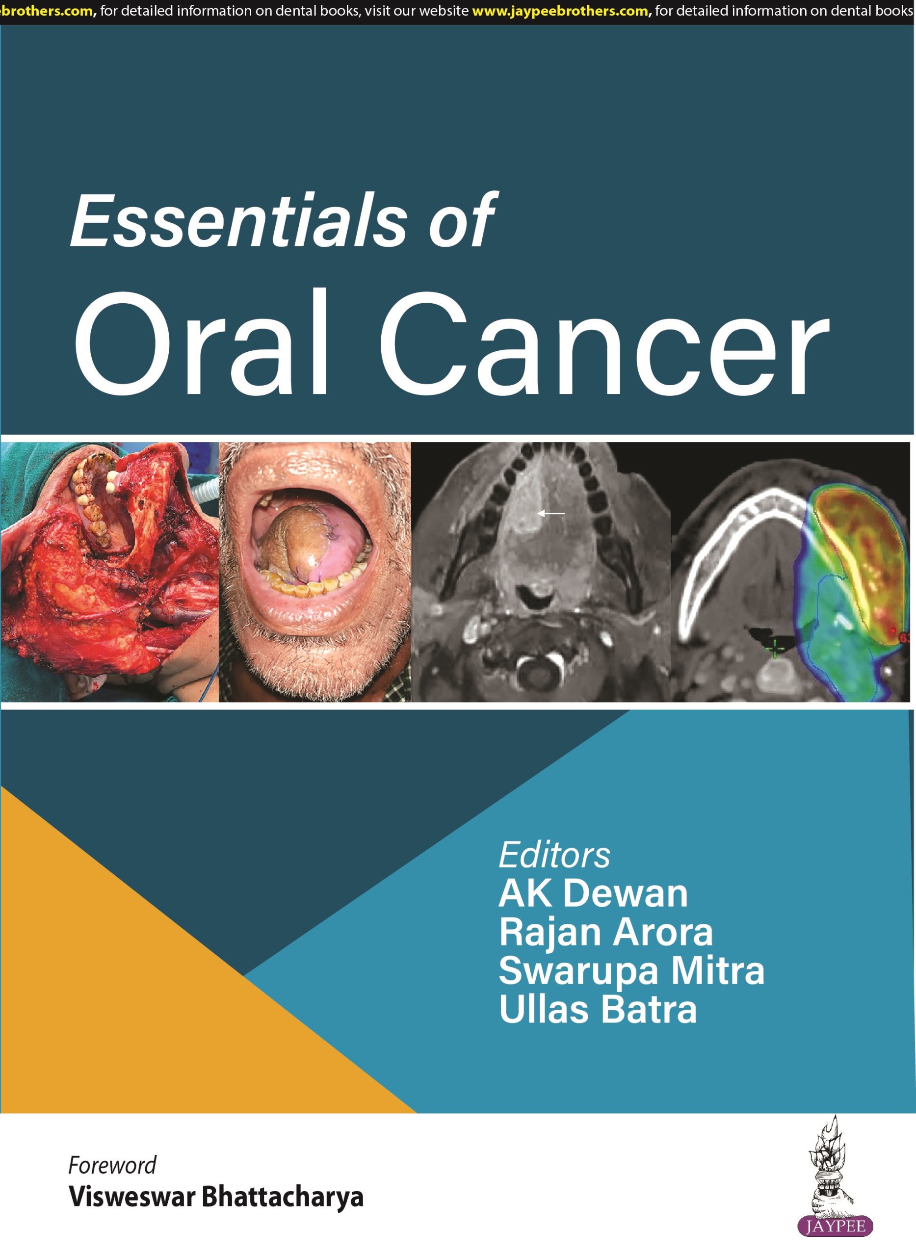 Essentials of Oral Cancer | Εκδόσεις Κωνσταντάρας