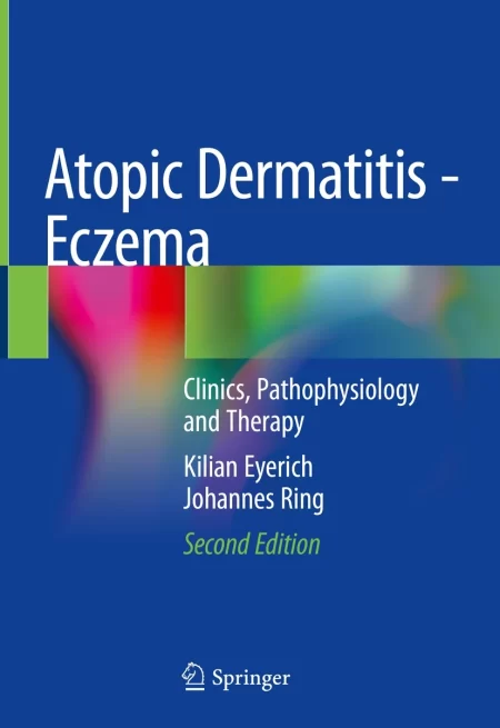 Atopic Dermatitis - Eczema. Clinics, Pathophysiology and Therapy ...