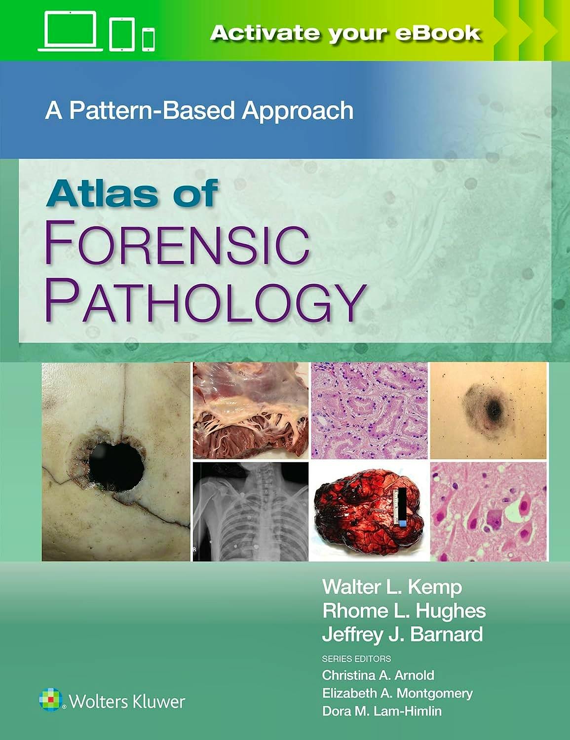Atlas of Forensic Pathology: A Pattern Based Approach: Print + eBook ...
