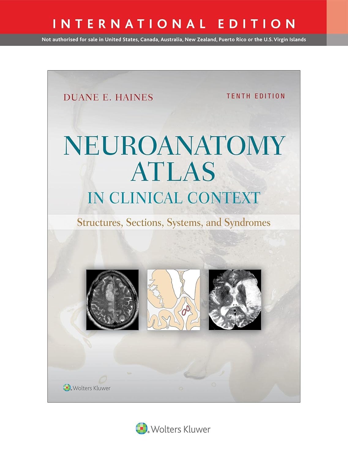 Neuroanatomy Atlas in Clinical Context. Structures, Sections, Systems ...