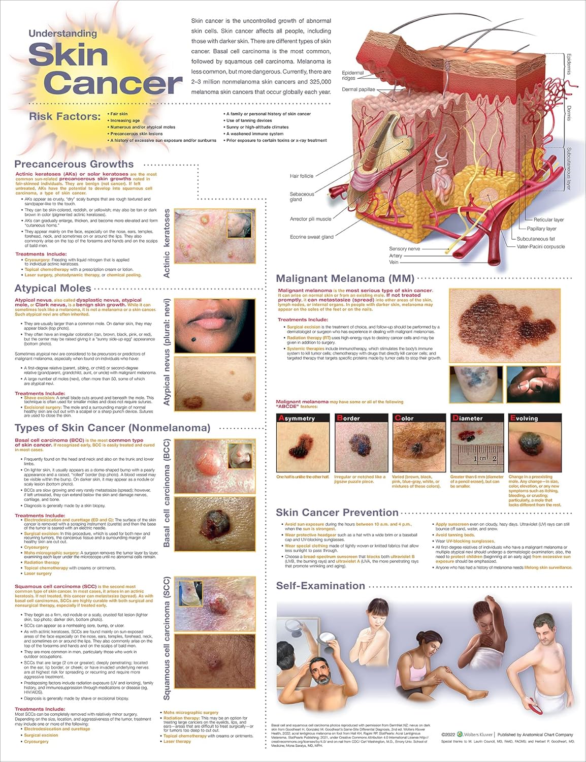 Understanding Skin Cancer Anatomical Chart Third edition | Εκδόσεις ...