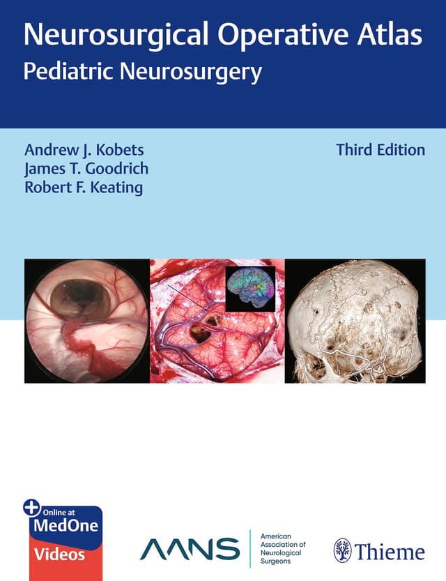 Neurosurgical Operative Atlas: Pediatric Neurosurgery | Εκδόσεις ...