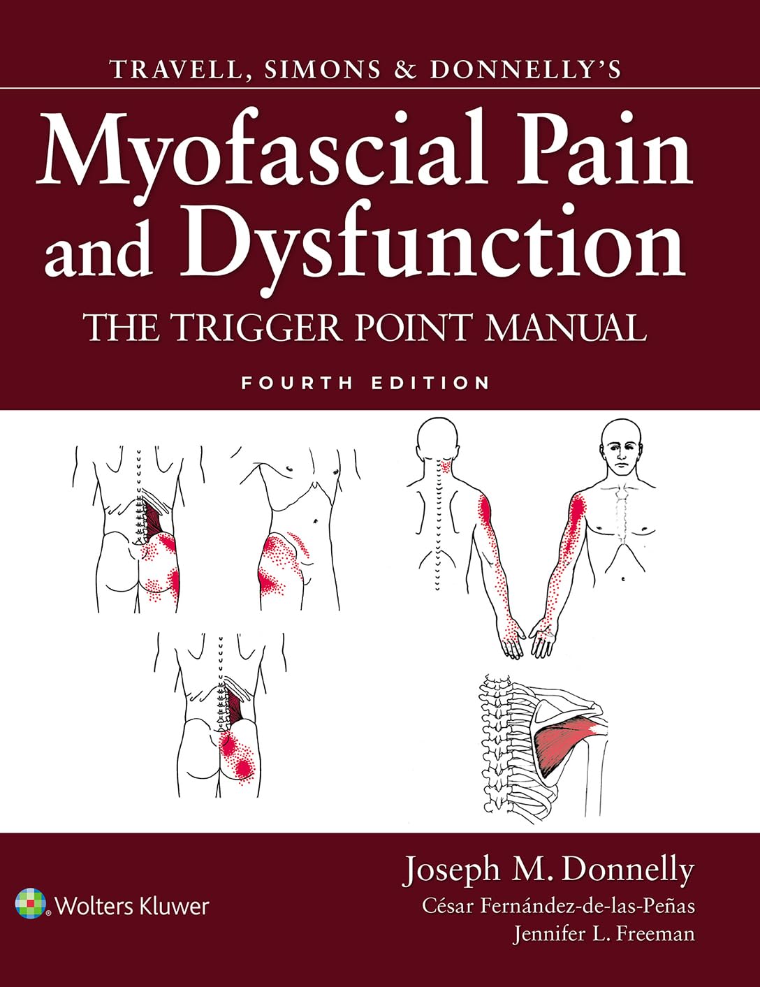 Travell, Simons & Donnelly's Myofascial Pain and Dysfunction. The ...
